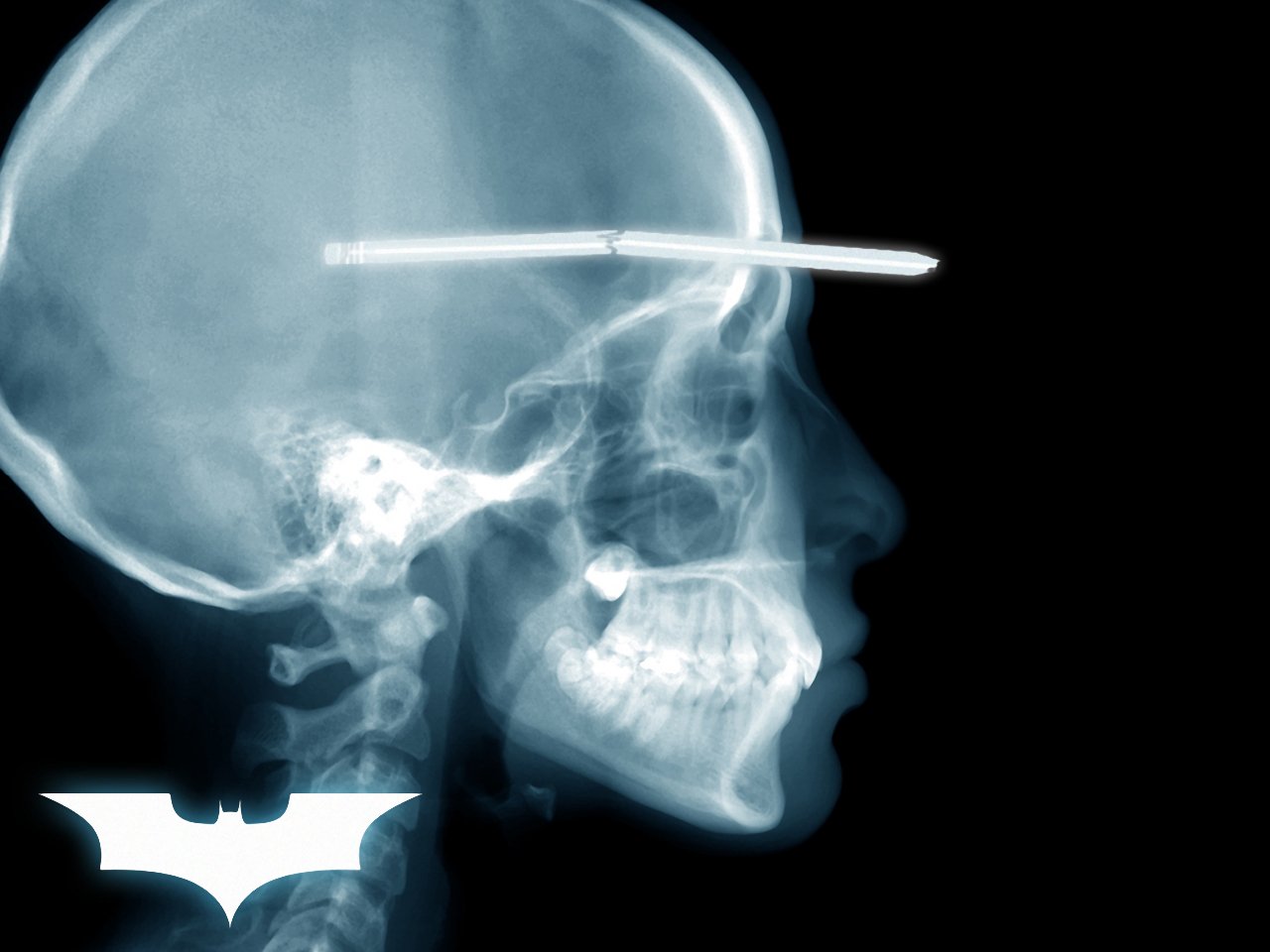 The Dark Knight: A Haunting X-Ray Encounter