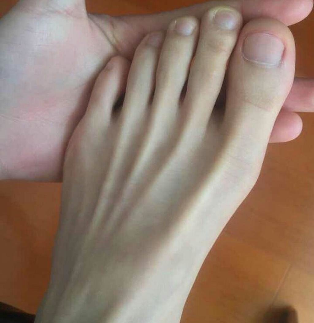 Toe - Desktop Wallpapers, Phone Wallpaper, PFP, Gifs, and More!